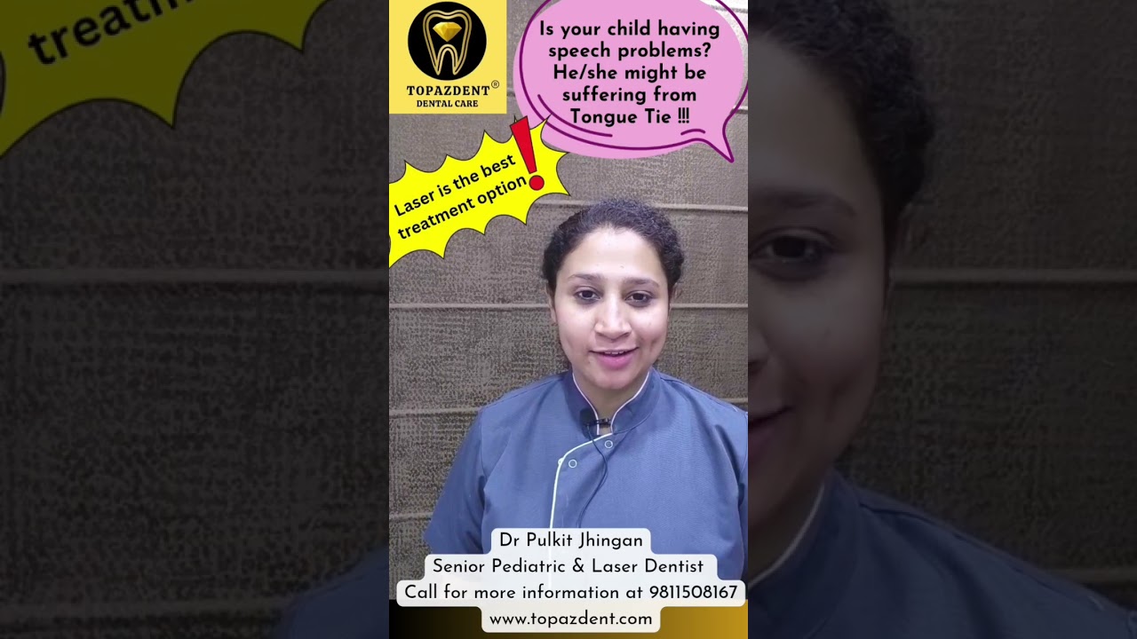 Laser frenectomy: A painless solution for tongue-tie in kids! Book now: www.topazdent.com