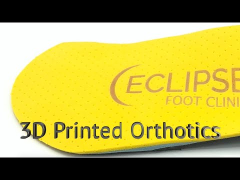 3D Printed Orthotics