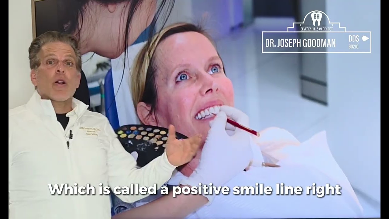 Large Dental Bridge for Missing Teeth: Complete Smile Restoration | In-House Lab Custom Veneers