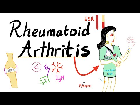 Rheumatoid Arthritis (RA) - Autoimmune Disease - Definition, Etiology& Epidemiology - Rheumatology