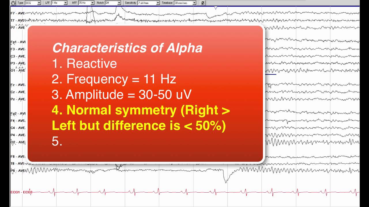6   Normal Awake EEG