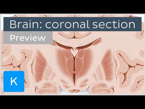 Coronal section of the brain at the level of the thalamus (preview) - Human Anatomy | Kenhub