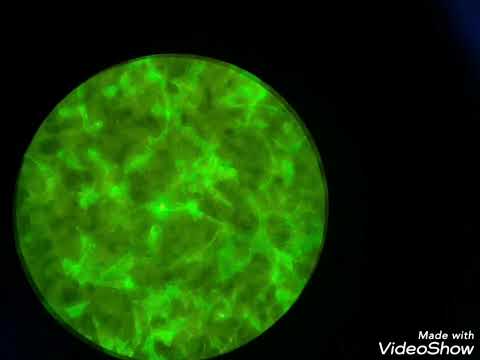 Detection of Antibody against adult acetylcholine receptor (AChR-E) by indirect immunofluorescence