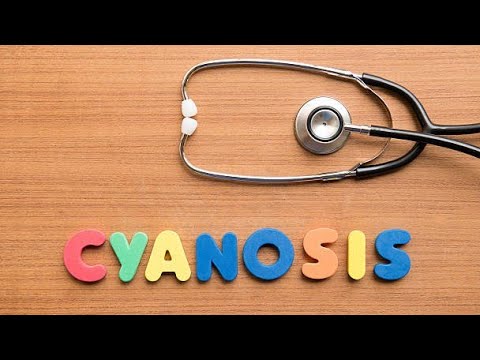 The cyanosis ( bluish purple ) Skin disease.