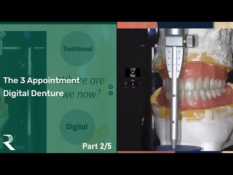 The 3 Appointment Digital Denture Webinar (part 2 of 5)