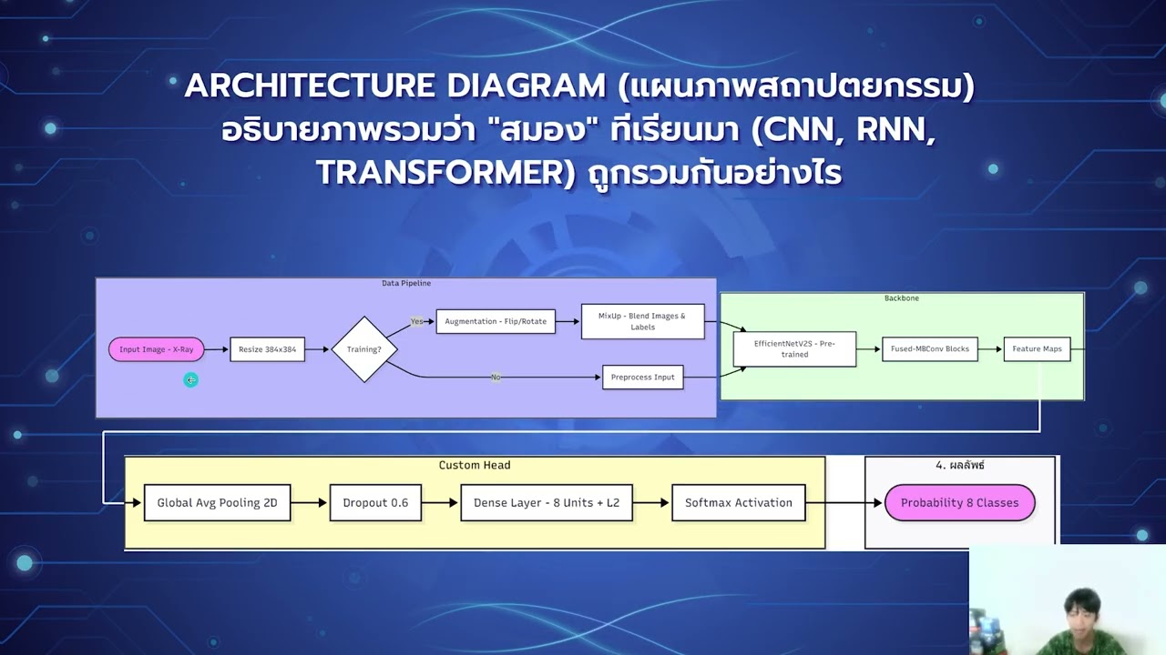 NIH CHEST X RAY DEEP LEARNING