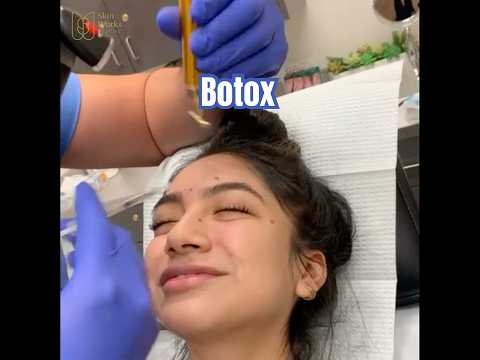 Botox | Skin Works Medical Spa #1 Medical Spa in the South Bay