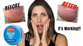I Tried O'Keeffe's Healthy Feet for 2 Weeks - AMAZING Results So Far!