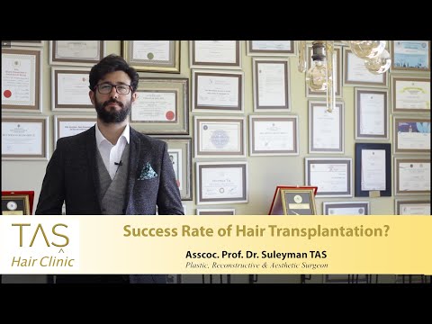 Success Rate of Hair Transplantation