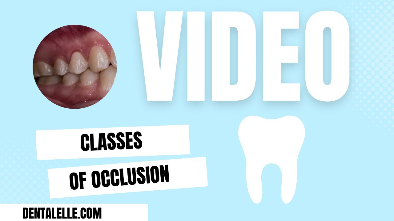 Dental Classes of Occlusion Explained