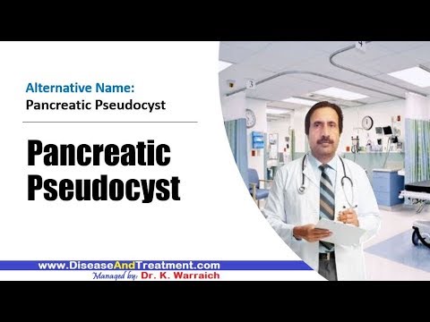 Pancreatic Pseudocyst : Causes, Diagnosis, Symptoms, Treatment, Prognosis