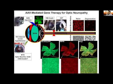 RGC specific promoter mediated gene therapy for neuroprotection of optic neuropathies