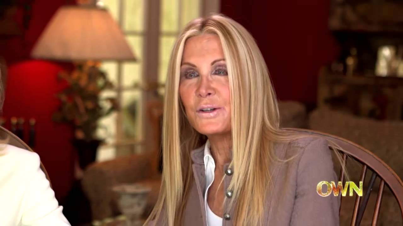 Joan Van Ark and Donna Mills Discuss Plastic Surgery | Where Are They Now | Oprah Winfrey Network