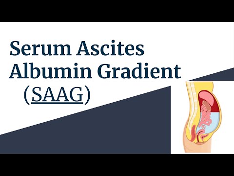 What is Serum Ascites Albumin Gradient (SAAG)?