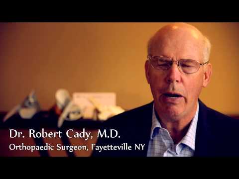 Ponseti Method - Dr. Robert Cady