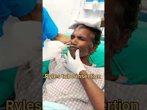 |Ryles tube insertion|😱 Procedure #shorts