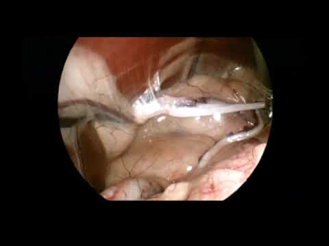 Cryptorchidism in dog LAP resolution