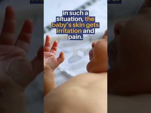 Newborn Baby Diaper Rash Treatment | How To treat baby diaper rash #shorts