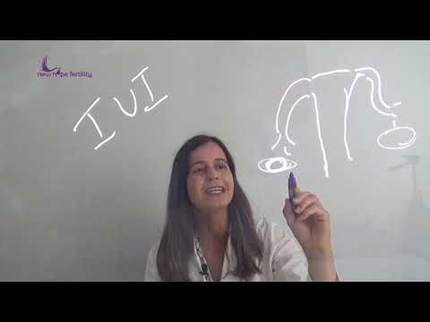 New Hope Fertility – Fertility Fact with Dr. Makarov: What is IUI?