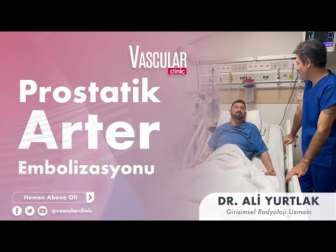 Ameliyatsız Prostat Tedavisi | Prostatik Arter Embolizasyonu