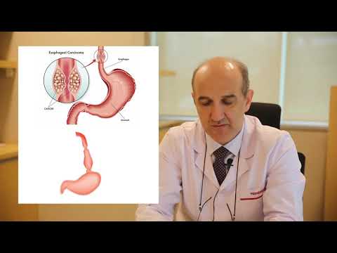 HASAN BATIREL, MD, PhD - Professor of Lung and Esophageal Surgery