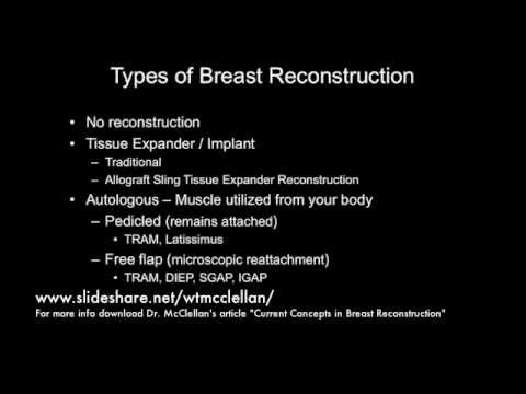 Live Lecture Breast Reconstruction Allograft Sling and Tissue Expander Lecture.m4v