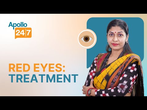 Treatment For Red And Itchy Eyes | Dr. C K Deepa