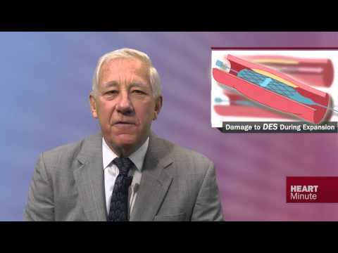 Heart Minute | DES May Become Damaged During Expansion