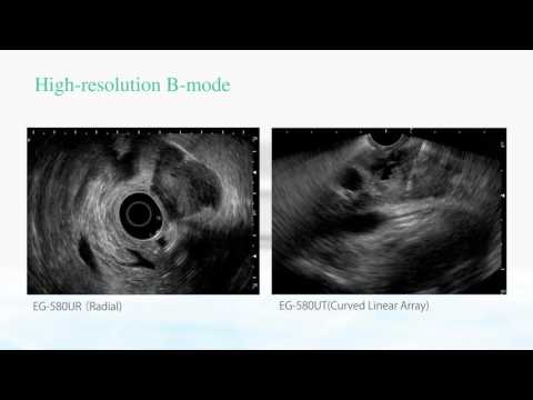 Fujifilm SU1 - Endoscopic Ultrasound System