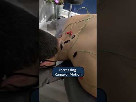 Look it's like acupuncture but more shocking ⚡️