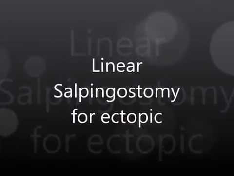 Linear salpingostomy for tubal ectopic pregnancy
