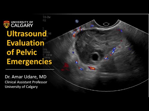 Ultrasound Evaluation of Pelvic Emergencies - Radiology Review