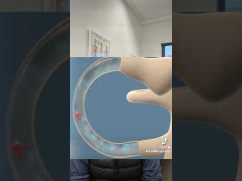 What’s the main causes of vertigo? #vertigo #chiropractor #wellbeing #anatomy