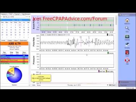 Does CPAP Cause Central Apneas? CPAP Induced Central Sleep Apnea. Interpret Sleep