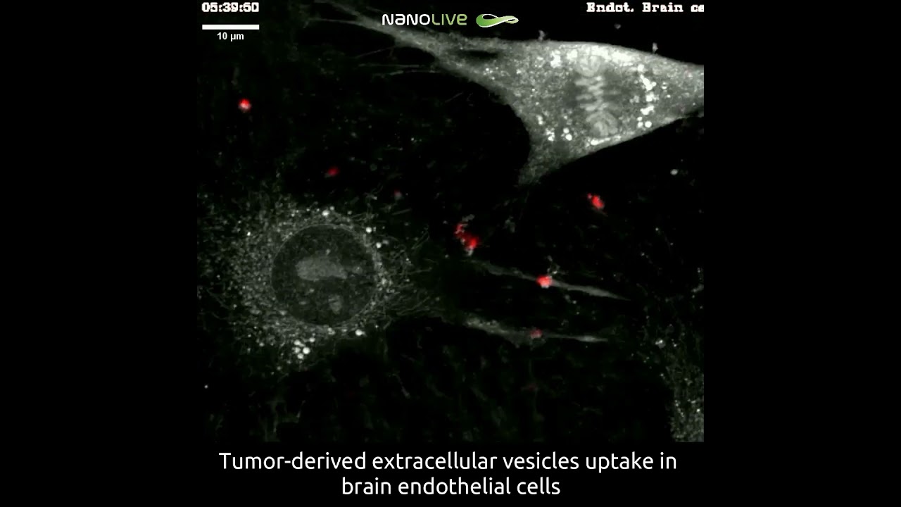Tumor-derived extracellular vesicles uptake in mouse brain endothelial cells