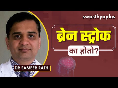 ब्रेन स्ट्रोक म्हणजे काय? | Brain Stroke in Marathi | Signs & Treatment | Dr Sameer Rathi