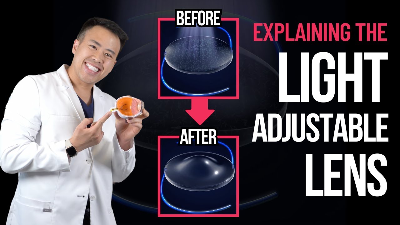 Light Adjustable Lens Compared to Multifocal for Cataract Surgery