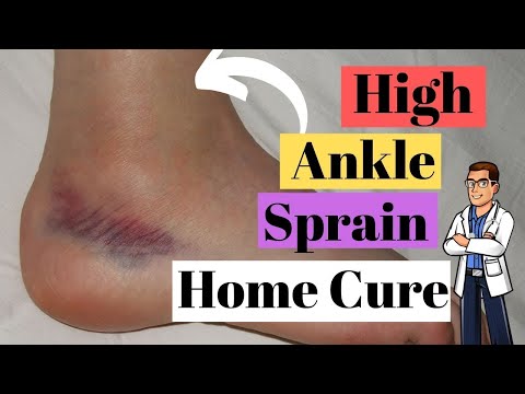 High Ankle Sprain Recovery Time: *The Best Treatment Guide!*