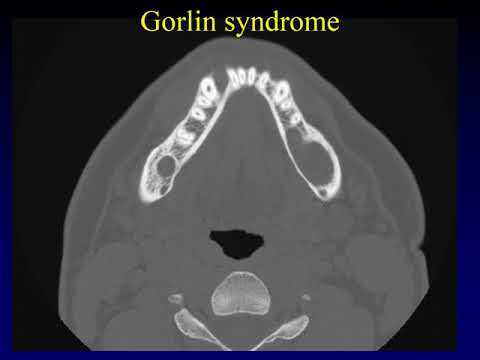 Diagnostic Imaging of the Jaw