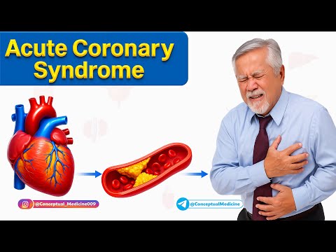 28. Acute Coronary Syndromes (ACS) 💔🚑 | Internal Medicine Cardiology Essentials for USMLE Step 2 CK