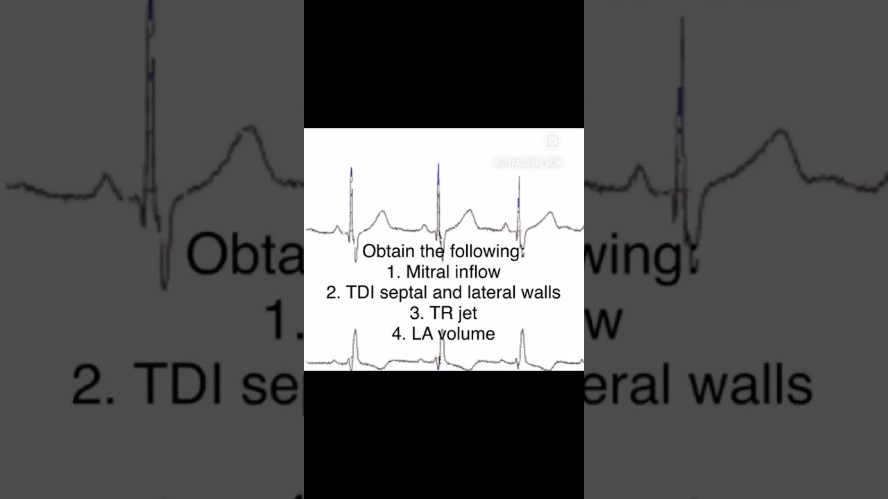 Diastolic dysfunction basics #echocardiography #ultrasoundstudent #echostudent