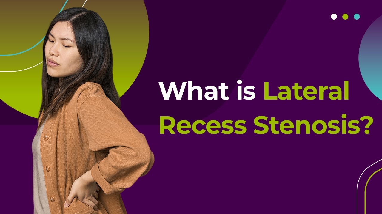 What is Lateral Recess Stenosis?