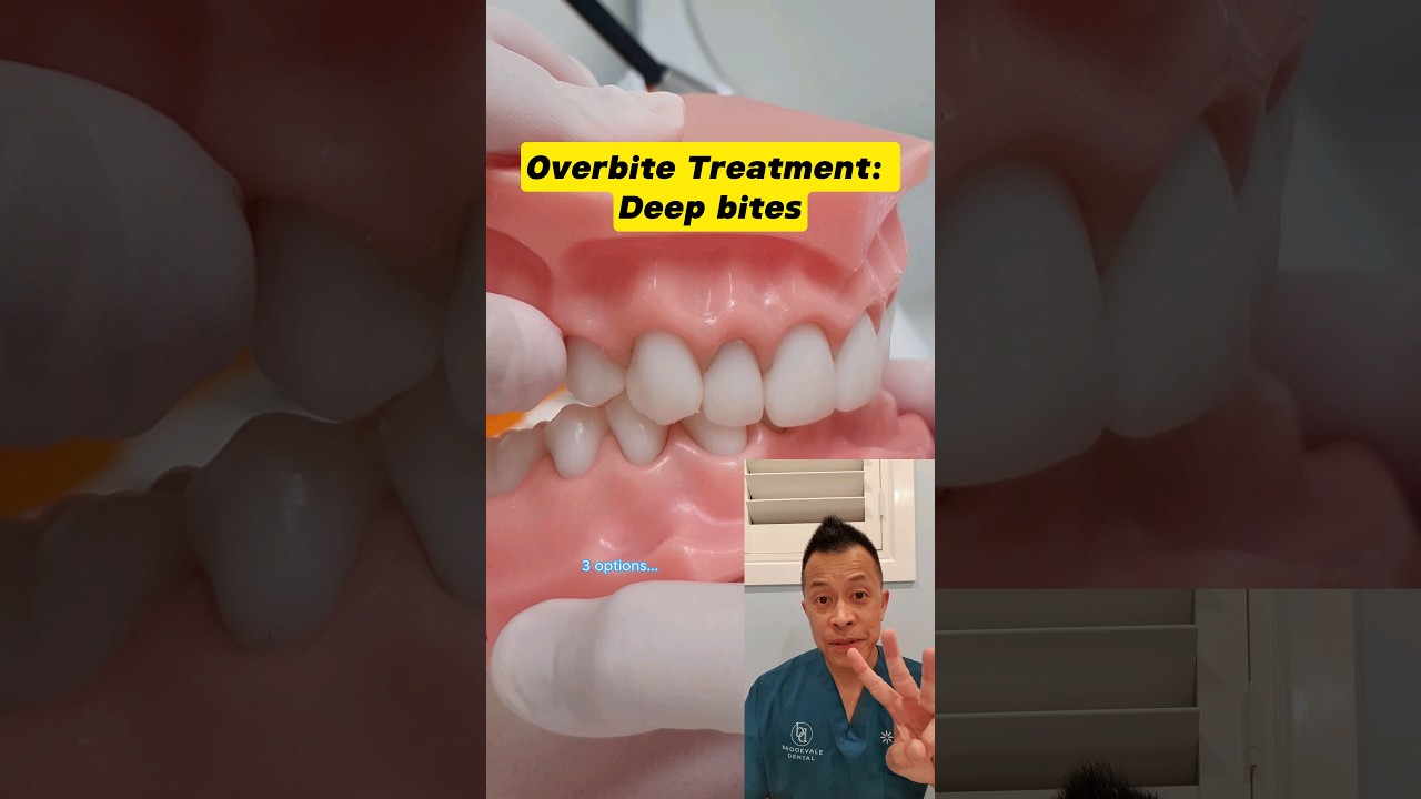 Perfecting Your Smile: 3 Overbite Correction Solutions!😁 #shorts #dentallan #occlusion #dentalhealth