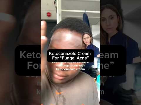 Ketoconazole Cream For “Fungal Acne” #dermreacts