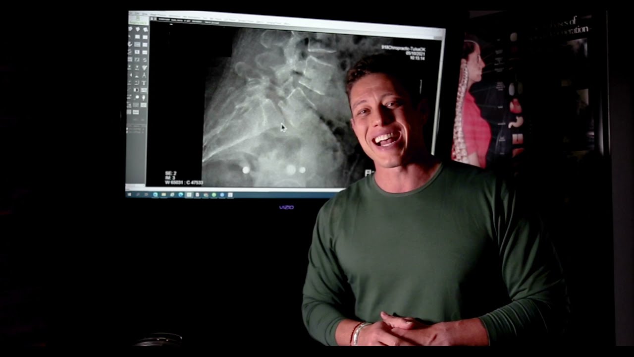 BROKEN BACK!!!! X-RAY