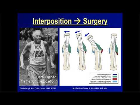 Orthopedic Interposition Injuries: You Only See What You Look For by Robert D. Boutin, M.D.