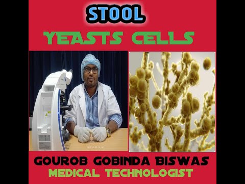 Yeast cells in stool microscopy. Fungal element in stool.