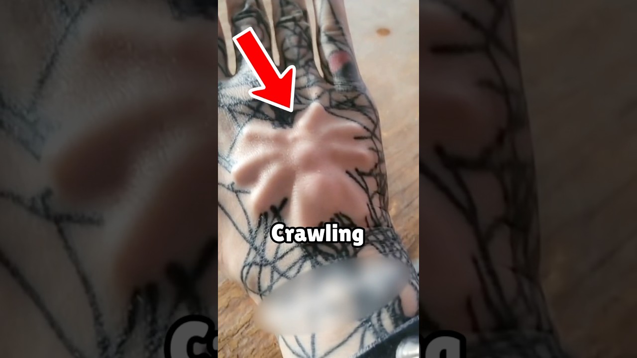 This Spider Will Crawl Under Skin 😨