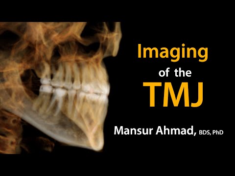 Imaging of the TMJ