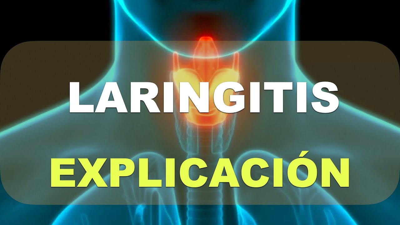 Laringitis: Qué es y síntomas